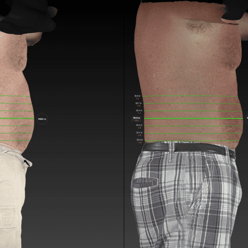 Fat Loss Red Light Therapy Weight Loss Before and After | Contours