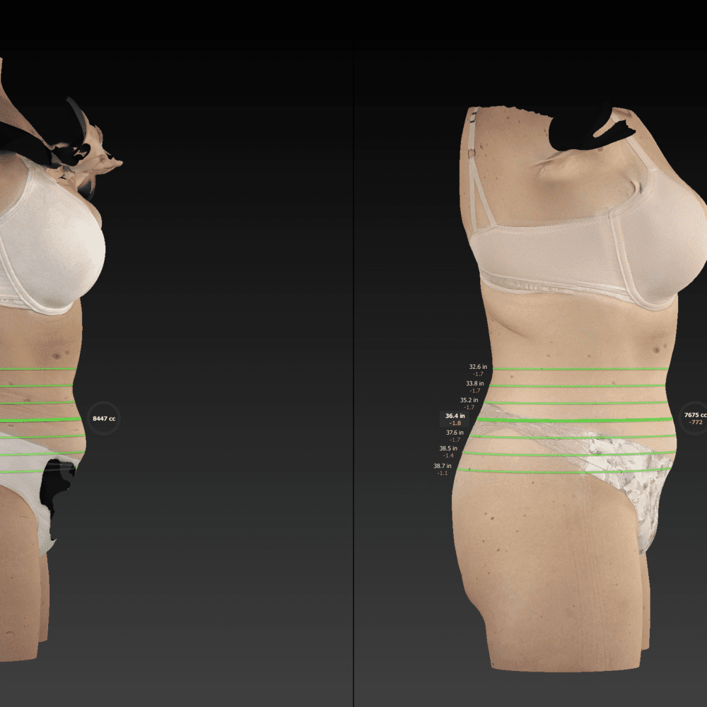 Fat Loss Red Light Therapy Weight Loss Before and After | Contours